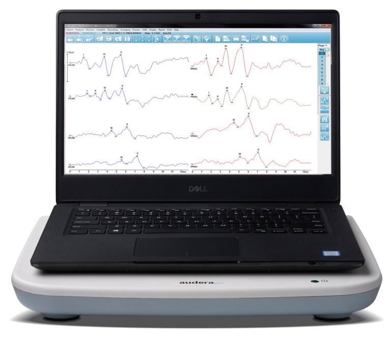 Potenciales Evocados Audera Pro – Serbinter