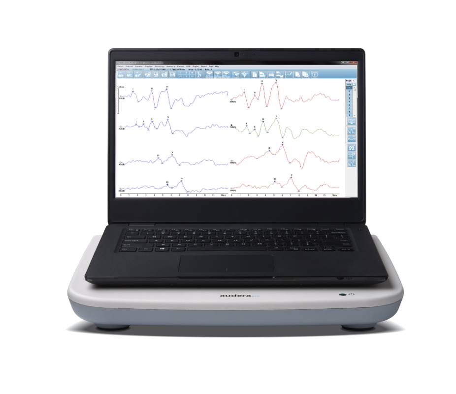 Potenciales Evocados Audera Pro – Serbinter